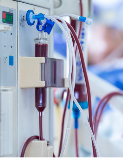 Blood Sensors for Hemodialysis Devices | DataMed